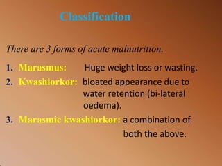 Malnutrition | PPT