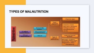 Malnutrition | PPTX