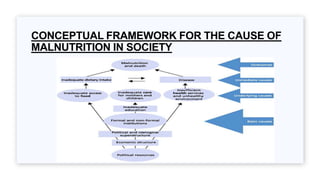 Malnutrition | PPTX