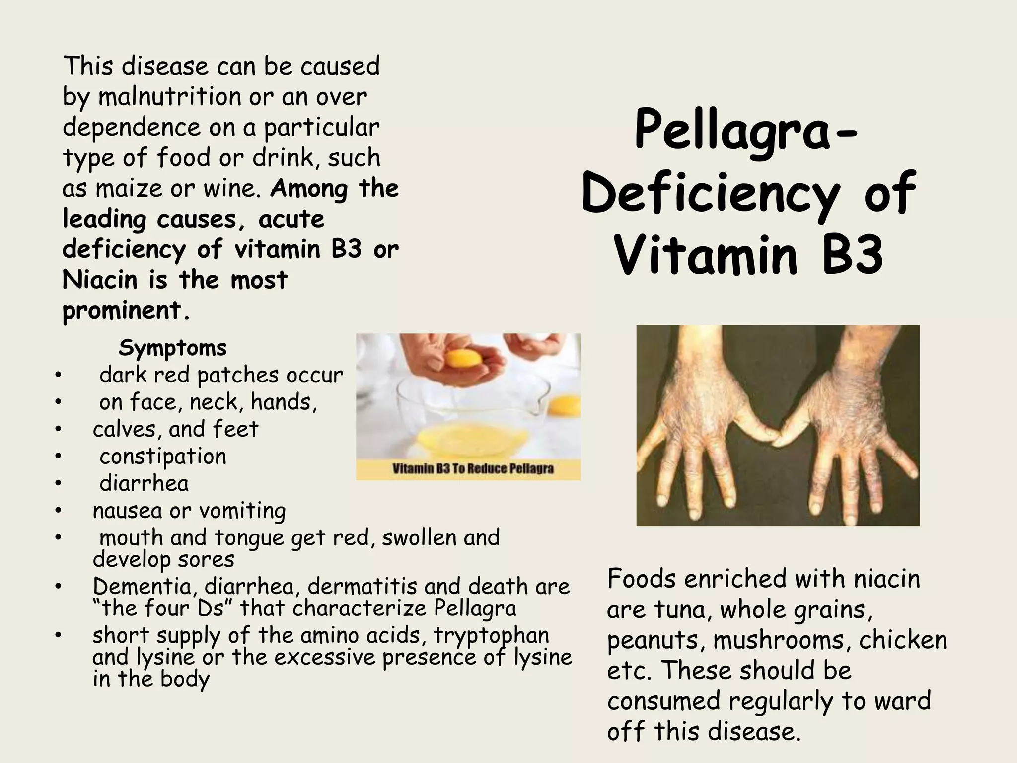 Malnutrition and deficiency diseases | PPTX