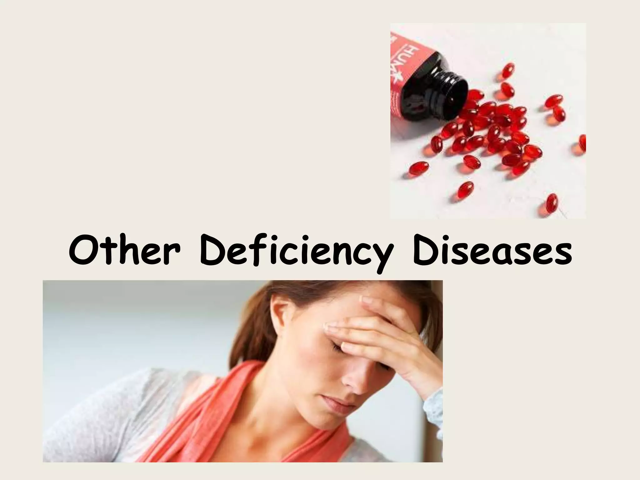Malnutrition and deficiency diseases | PPTX