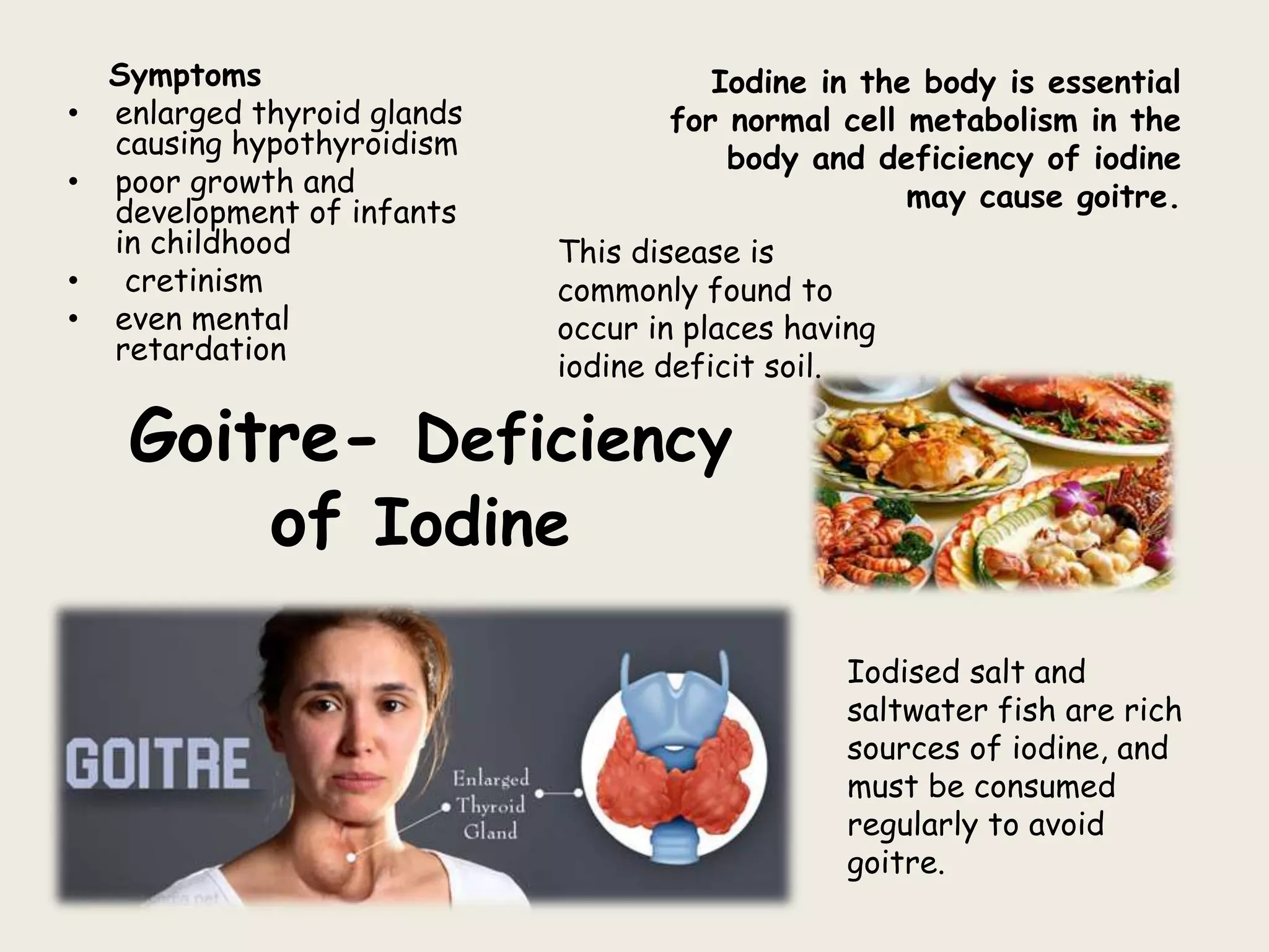 Malnutrition and deficiency diseases | PPTX