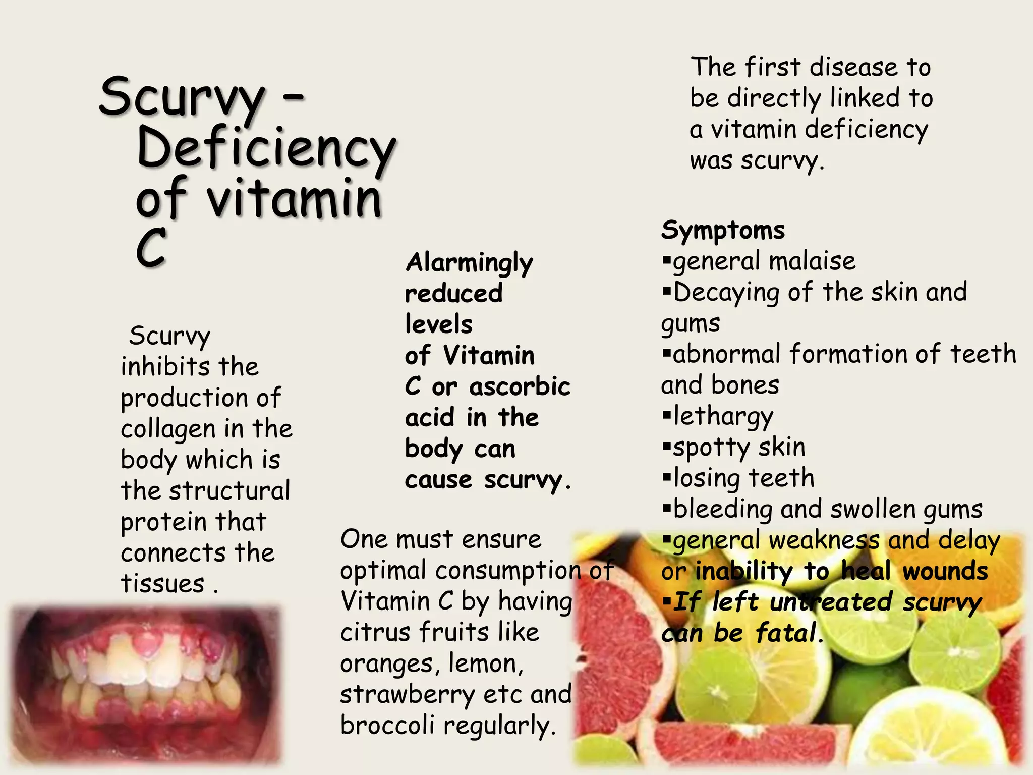 Malnutrition and deficiency diseases | PPTX