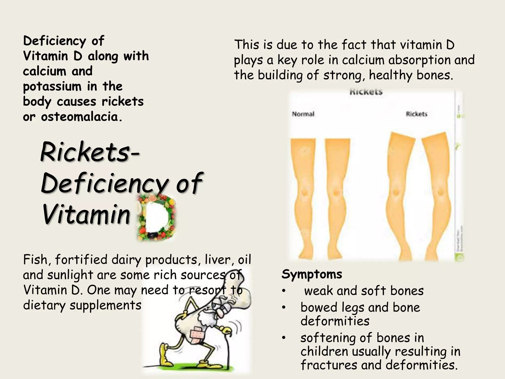 Malnutrition and deficiency diseases | PPTX