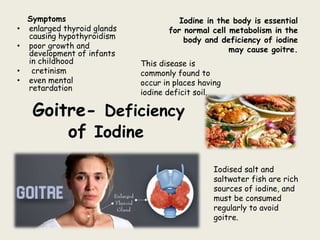 Malnutrition and deficiency diseases | PPTX