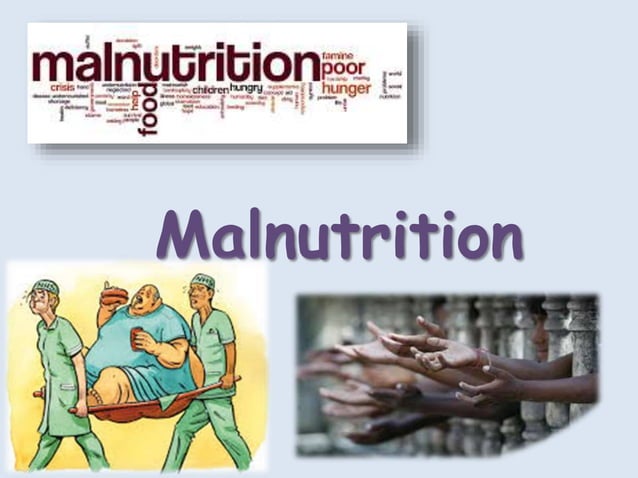 Malnutrition and deficiency diseases | PPTX | Nutrition | Healthy Living
