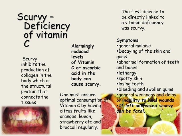 Malnutrition and deficiency diseases | PPTX | Nutrition | Healthy Living