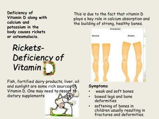 Malnutrition and deficiency diseases | PPTX