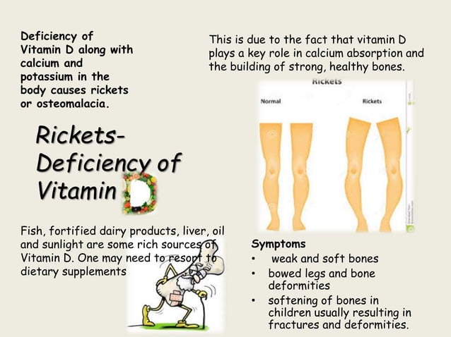 Malnutrition and deficiency diseases | PPTX | Nutrition | Healthy Living
