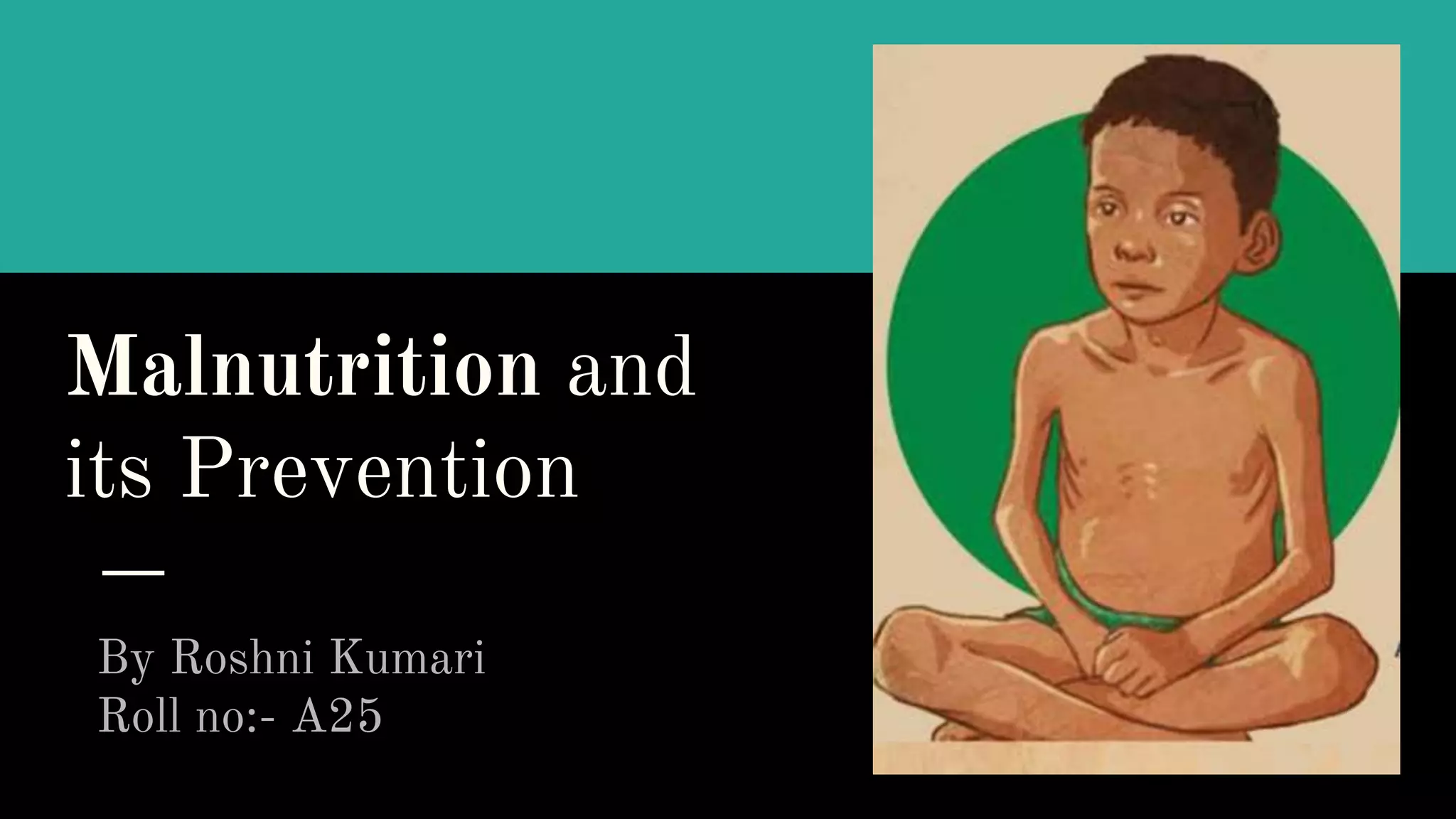 Malnutrition and its prevention.pptx