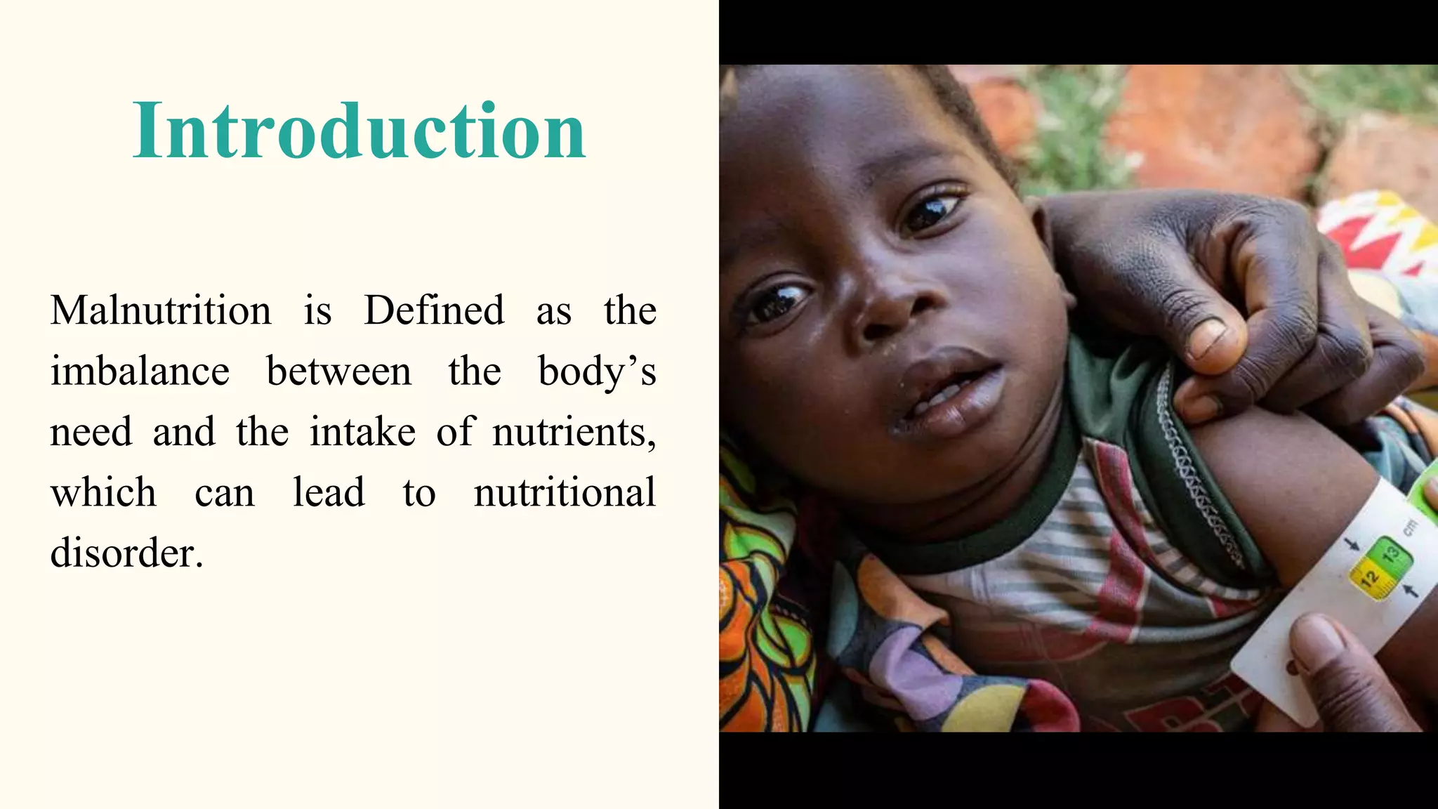 Malnutrition and its prevention.pptx