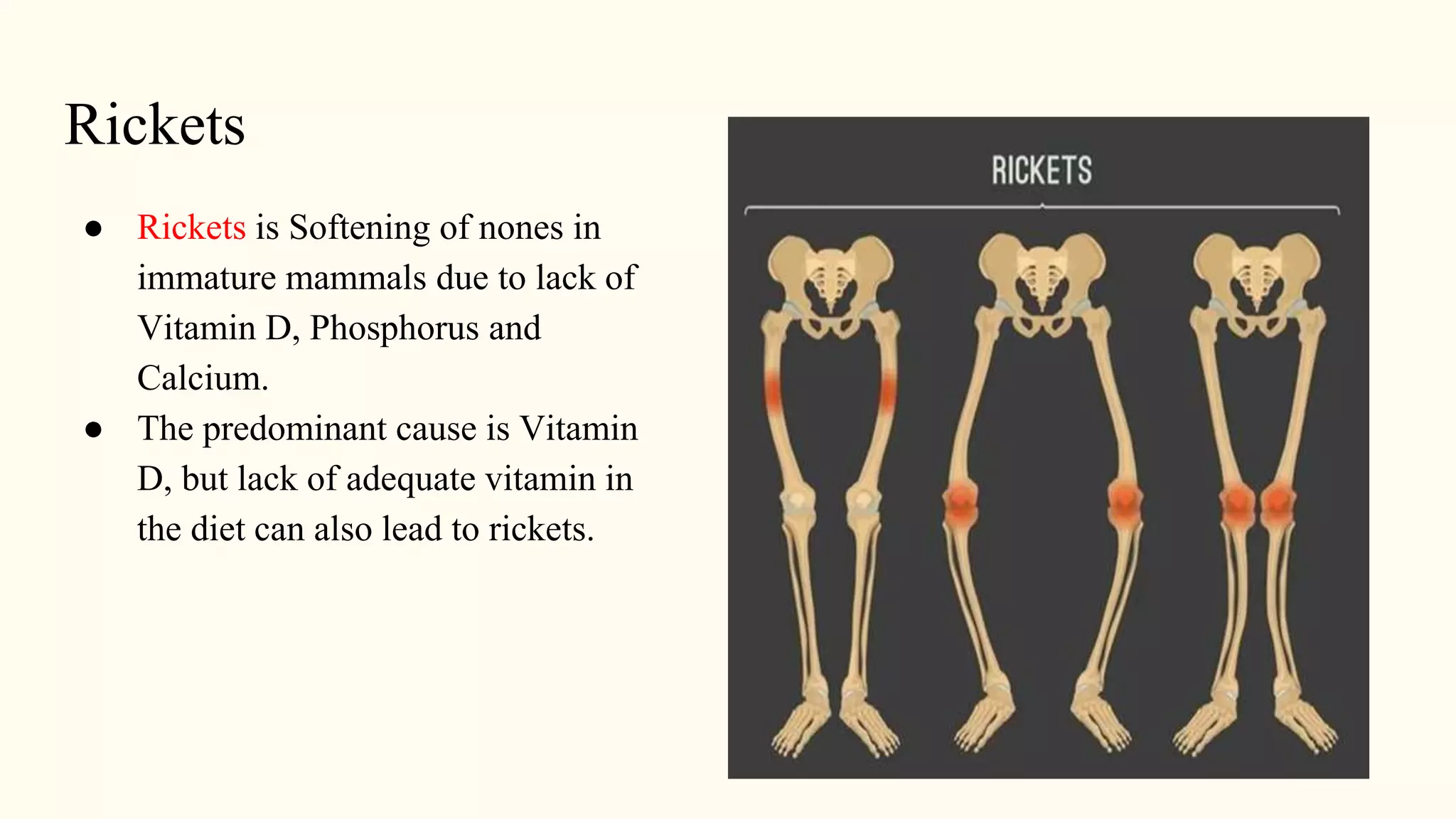 Malnutrition and its prevention.pptx