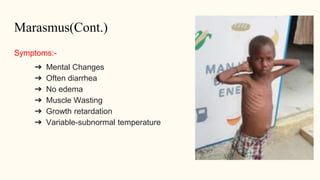 Malnutrition and its prevention.pptx