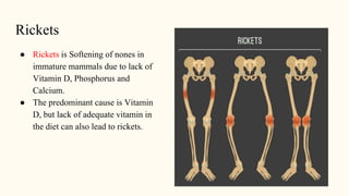 Malnutrition and its prevention.pptx