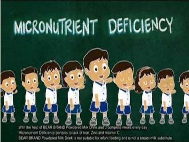 Malnutrition and Micronutrients Deficiency | PPTX | Nutrition | Healthy ...
