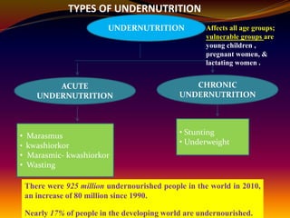 Malnutrition by dr najeeb | PPTX