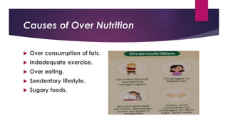 Malnutrition by Neha.pdf | Diseases and Conditions | Medical Health