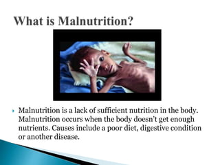 Malnutrition by Nikita.pptx