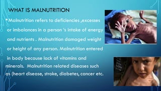 Malnutrition by Renu.pdf