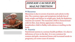 Malnutrition by Shivangi.pptx