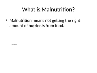 Malnutrition_Grade5_With_Images_Notes (1).pptx