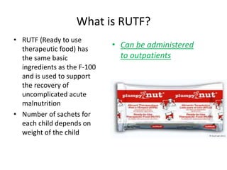 Malnutrition harare hosp(3) | PPTX