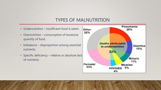 Malnutrition in india | PPTX