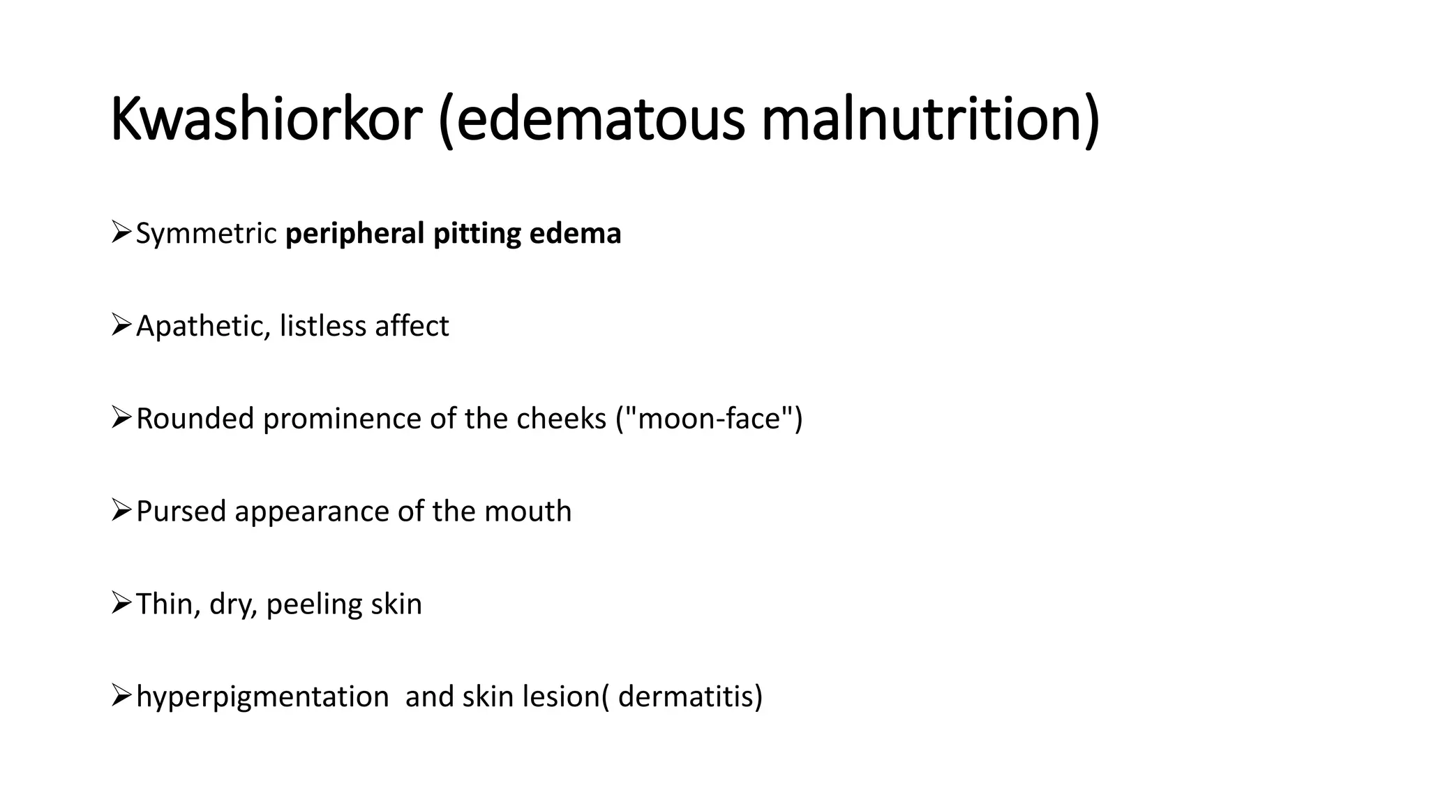 Malnutrition in pediatrics | PPTX