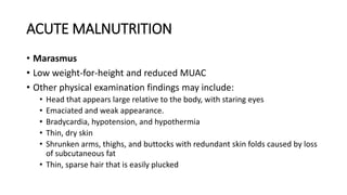 Malnutrition in pediatrics | PPTX