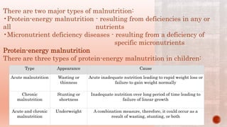Malnutrition and its remedies | PPTX