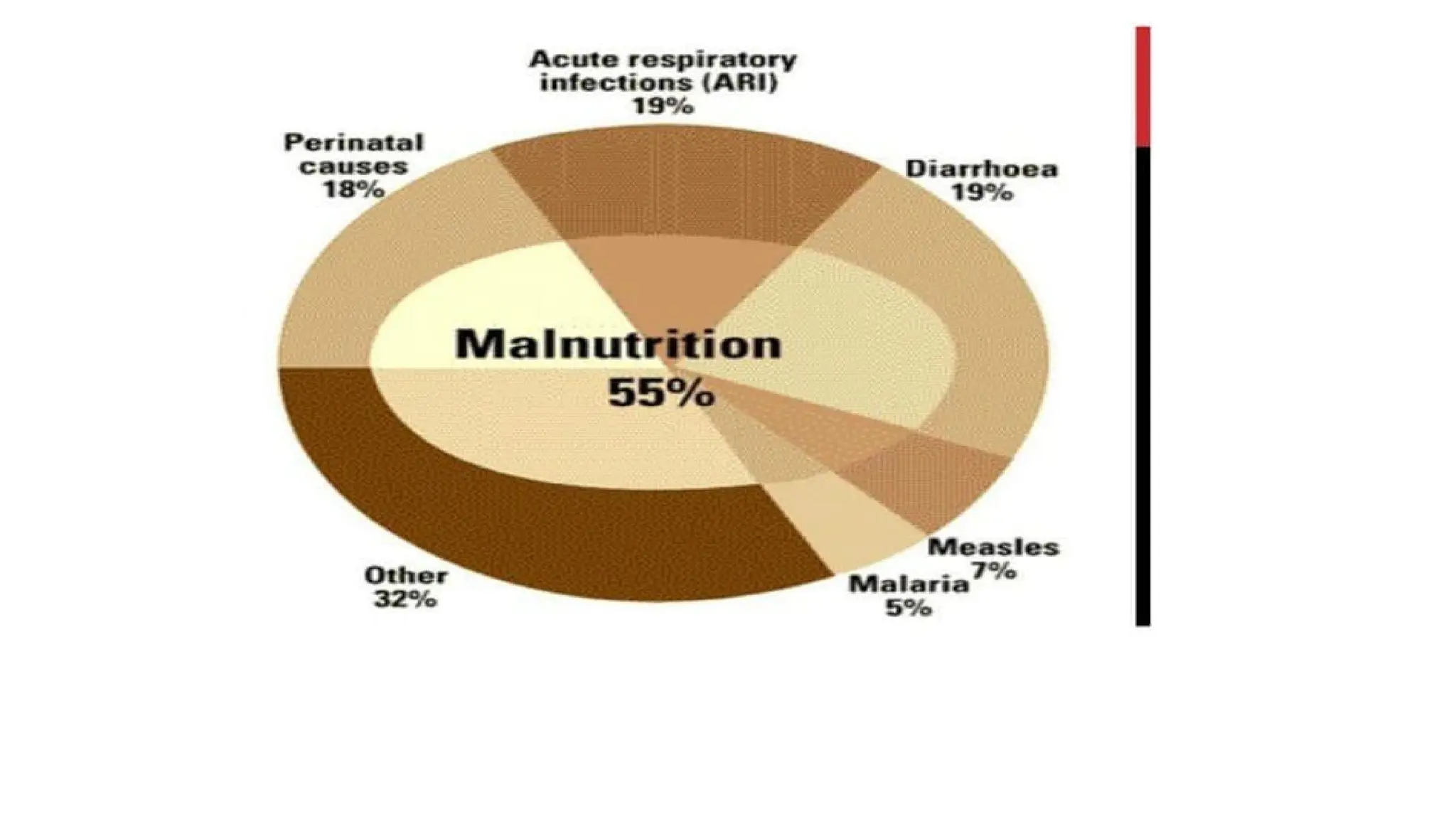 Malnutrition,PEM( kwashiorkor,marasmus).pptx