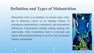 Factors Effecting Malnutrition Slideshare.pptx