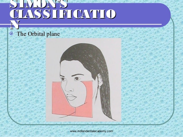classification of Malocclusion /certified fixed orthodontic courses