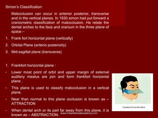 Malocclusion | PPT