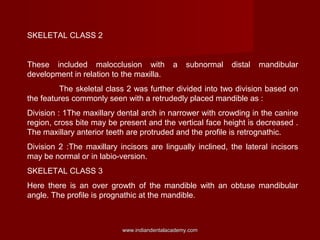 Malocclusion | PPT