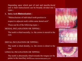 Malocclusion | PPT