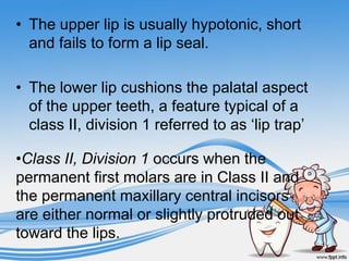 Malocclusion | PPTX