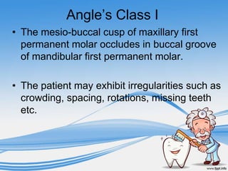 Malocclusion | PPTX
