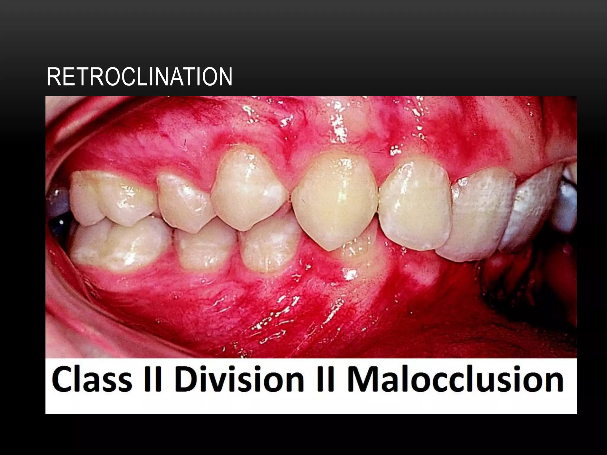 Malocclusion - Dr. Maher Fouda | PPTX