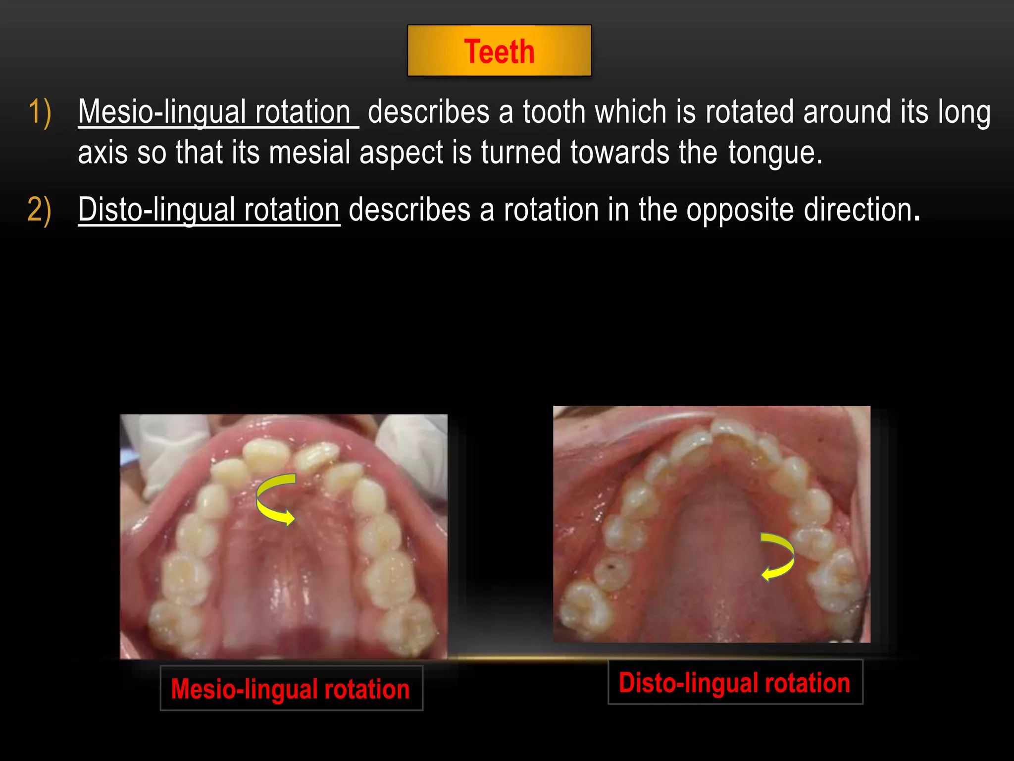 Malocclusion - Dr. Maher Fouda | PPTX