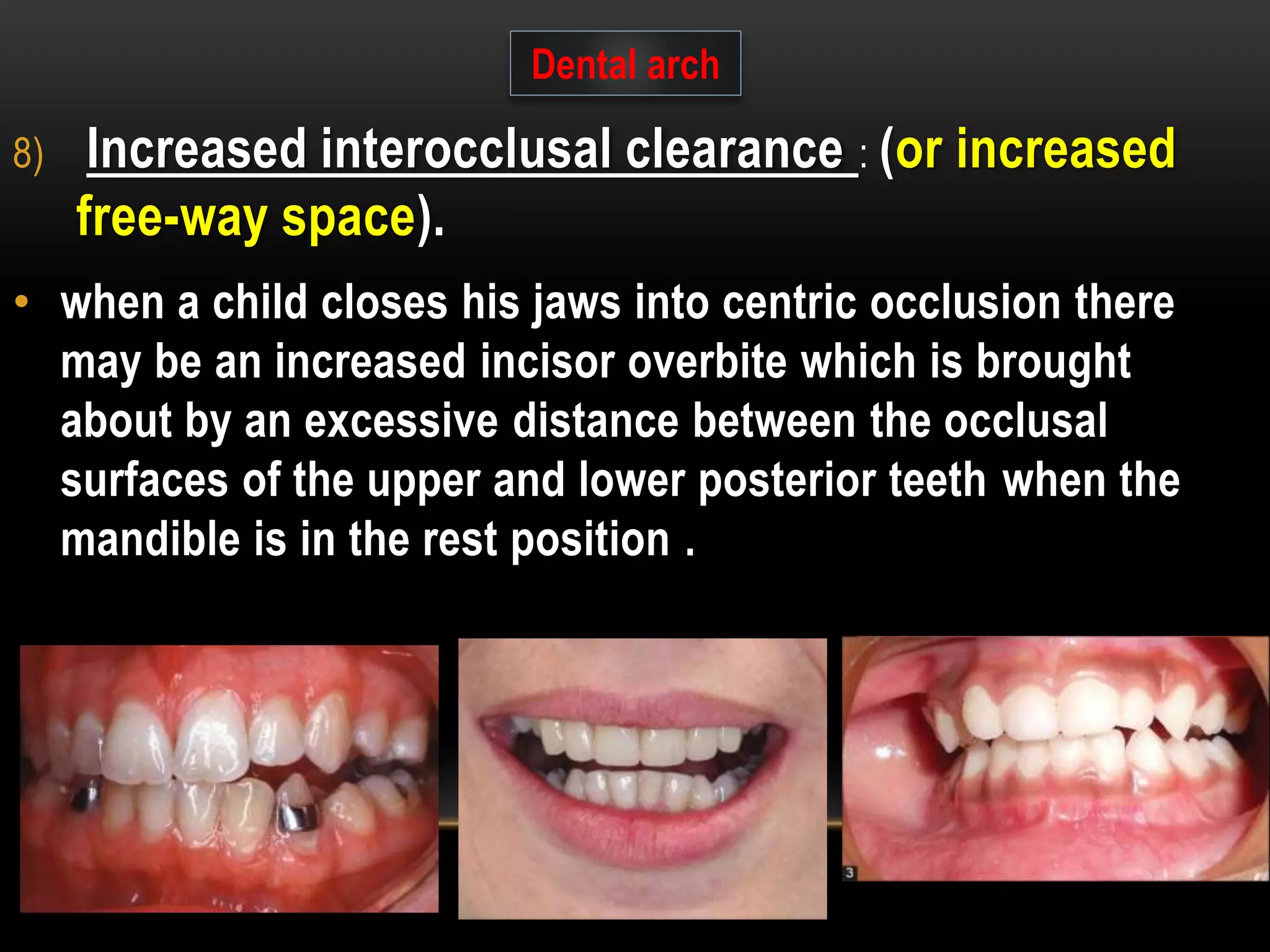 Malocclusion - Dr. Maher Fouda | PPTX