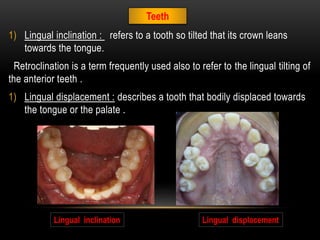 Malocclusion - Dr. Maher Fouda | PPTX