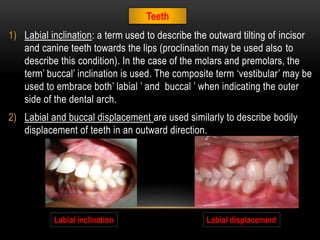 Malocclusion - Dr. Maher Fouda | PPTX