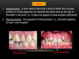 Malocclusion - Dr. Maher Fouda | PPT
