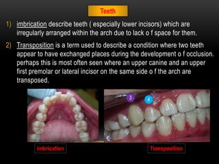Malocclusion - Dr. Maher Fouda | PPT