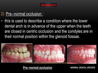 Lower Dental Arch