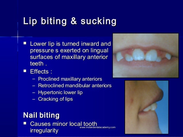 Malocclusion general factors /certified fixed orthodontic courses b…