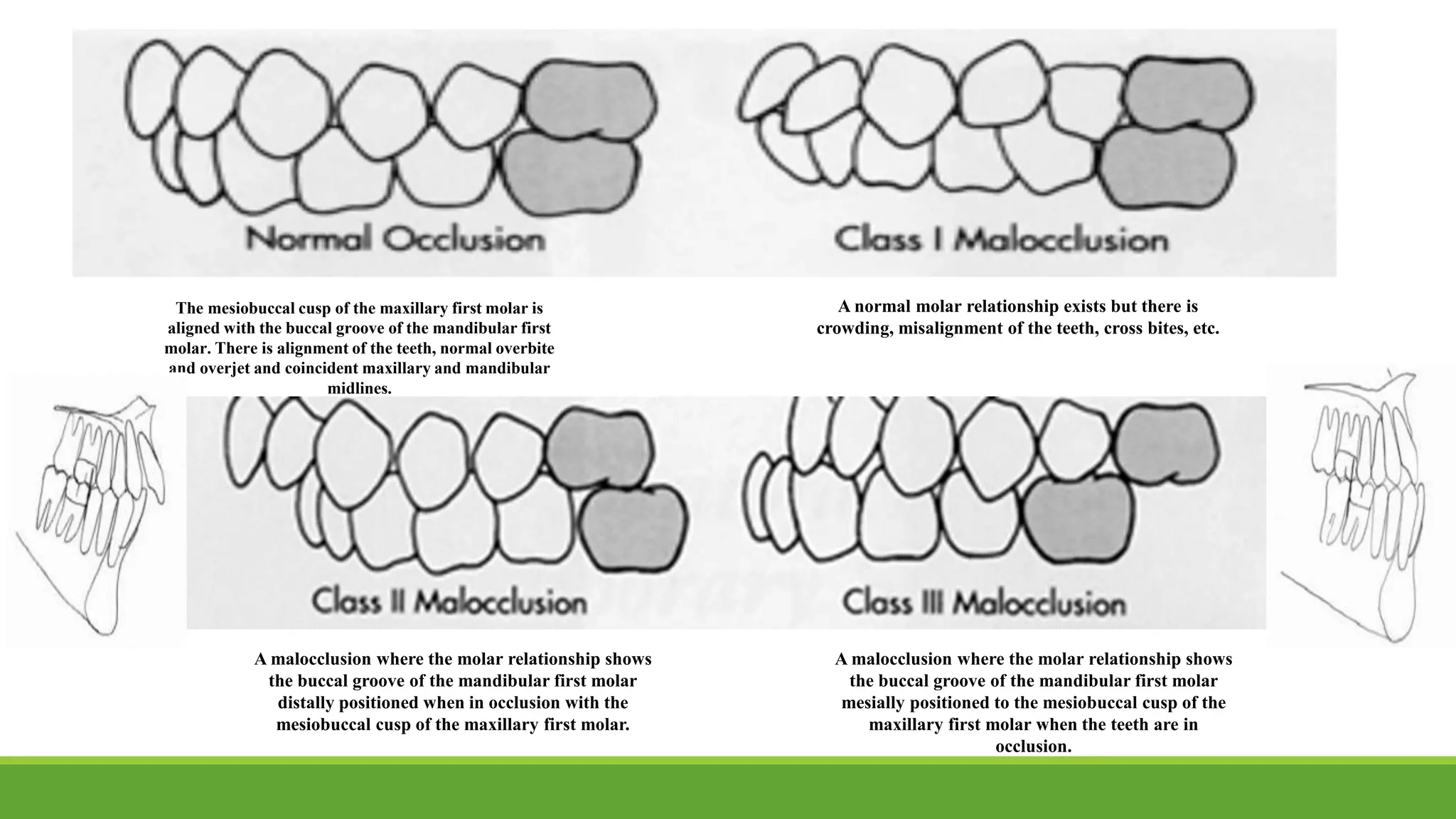 Malocclusion & Orthodontic Treatment | PPTX