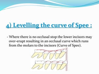 Malocclusion considerations regarding orthodontic cast analysis | PPTX