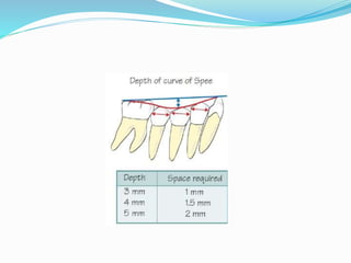 Malocclusion considerations regarding orthodontic cast analysis | PPTX